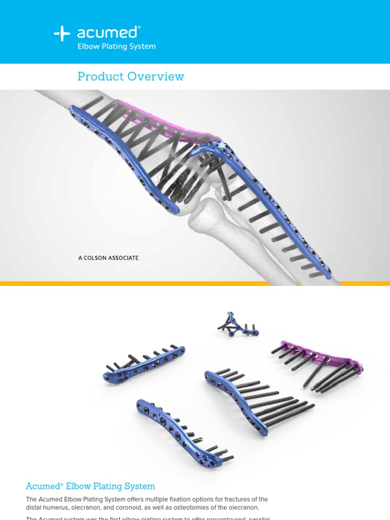 Acumed Brochure EN Elbow Plating System ELB10 00 B | PDF | Elbow ...