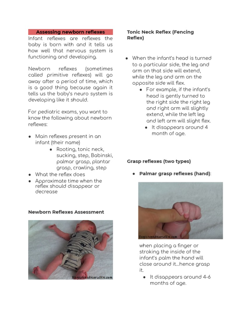 Assessing Newborn Re Exes: Tonic Neck Re Ex (Fencing Re Ex) | PDF ...