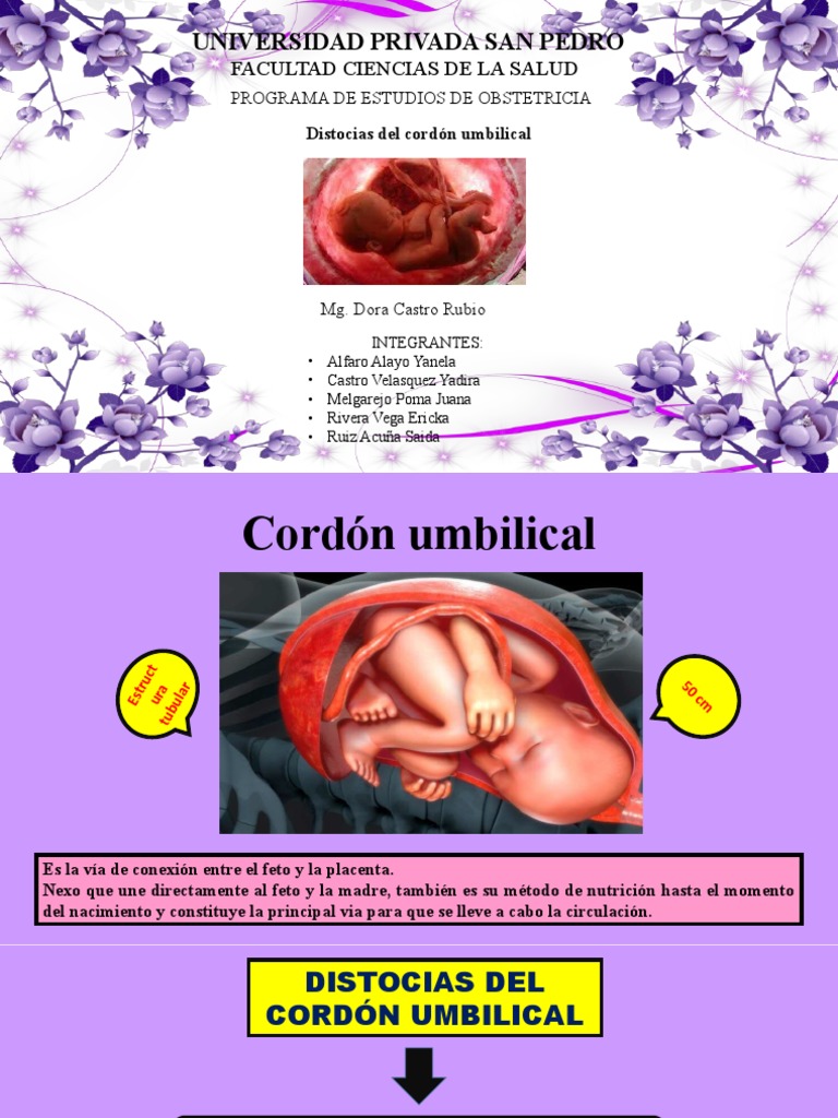 Distocia Funicular O3 | PDF | Parto | Placenta