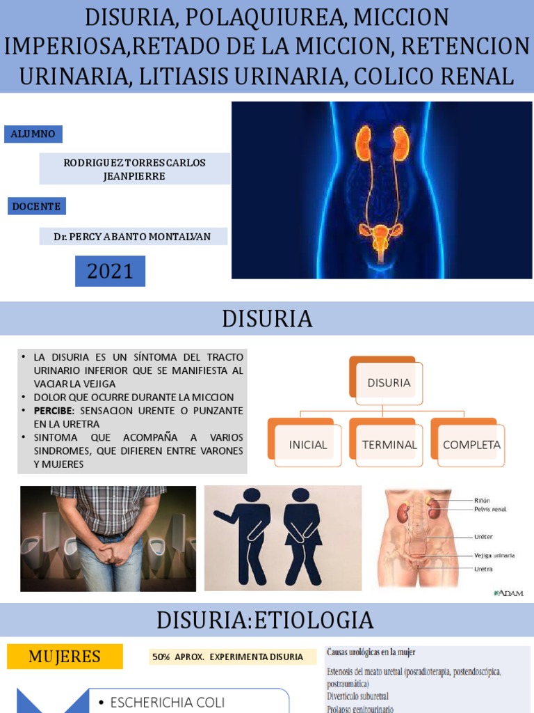 Exposicion Disuria | PDF | Vejiga urinaria | Infección del tracto urinario