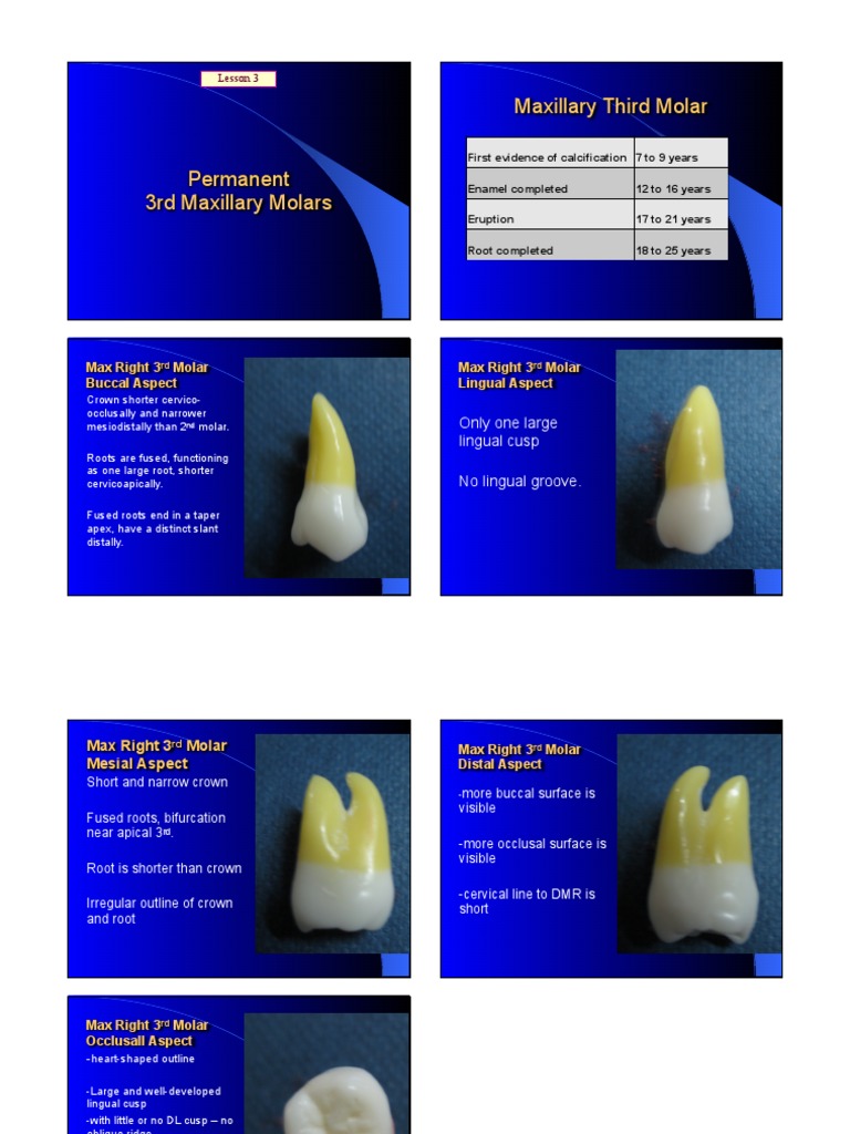 Mod 8 L3 Maxillary 3rd Molars | PDF