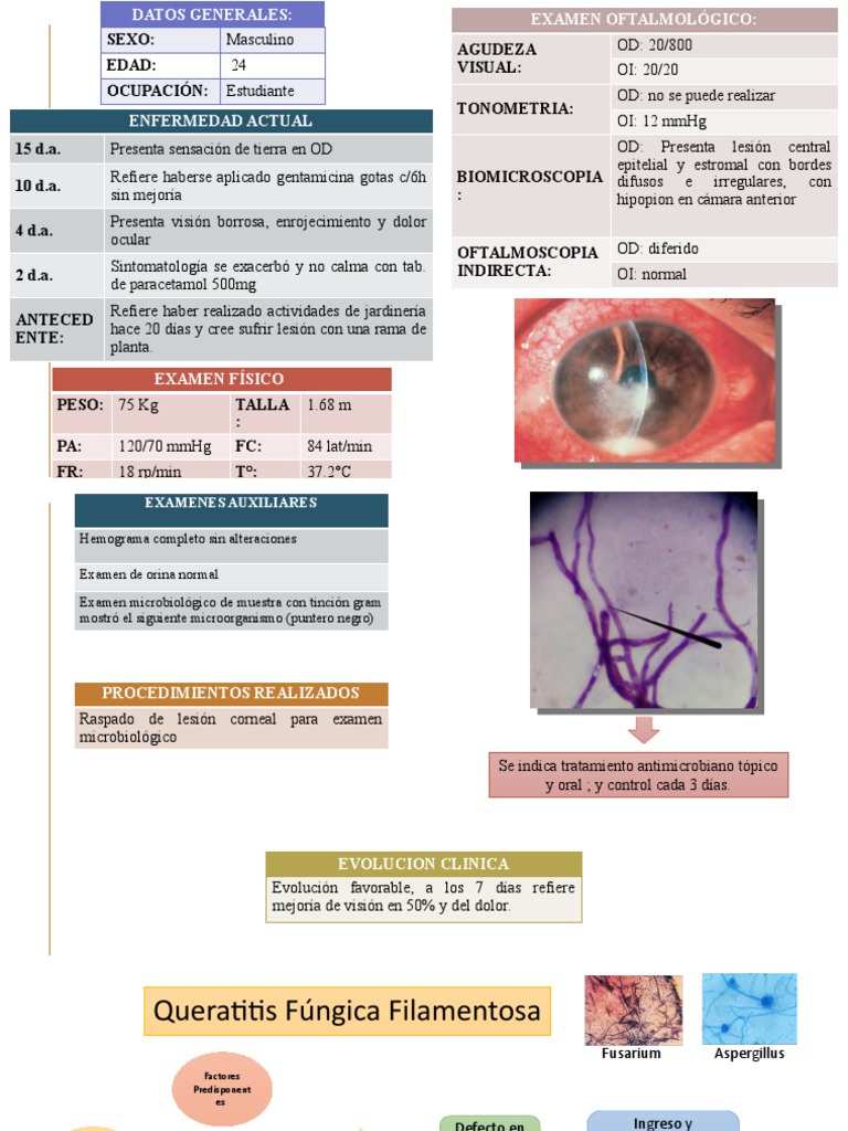 Queratitis Fúngica Filamentosa | PDF | Medicina CLINICA ...