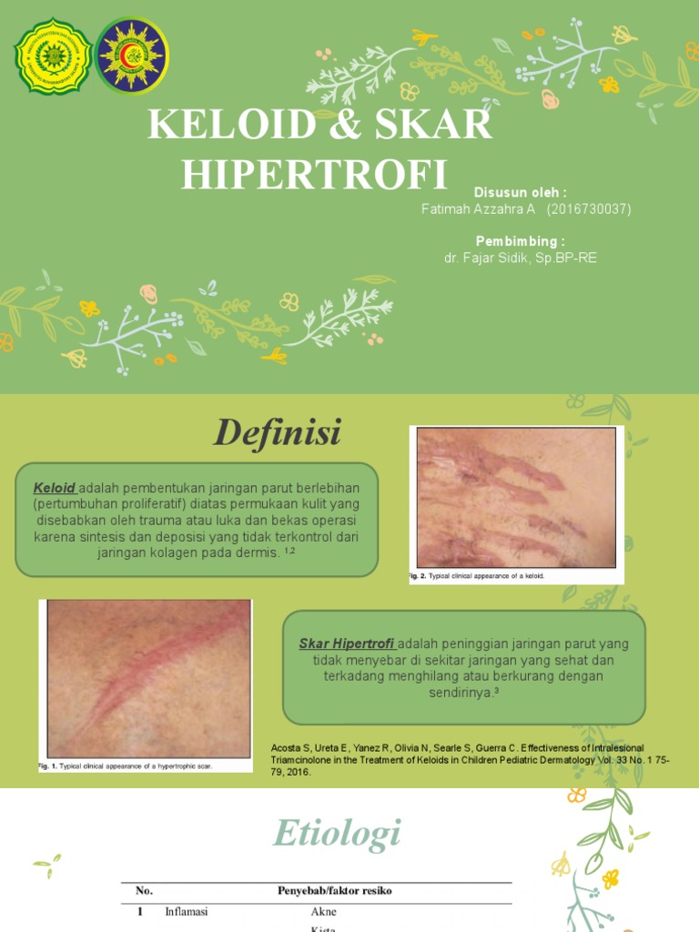 Keloid & Hipertrofi Scar | PDF