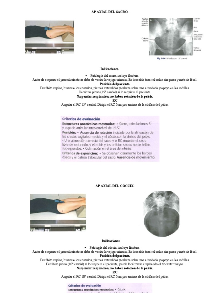 Radiografías del Sacro y Coxis | PDF | Pelvis | Rodilla