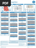 Cardiac Dysrhythmias | PDF | Electrocardiography | Cardiovascular System
