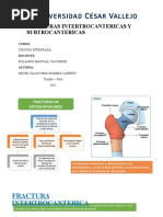 Clasificacion de Tronzo - Buscar Con Google | PDF | Sistema ...