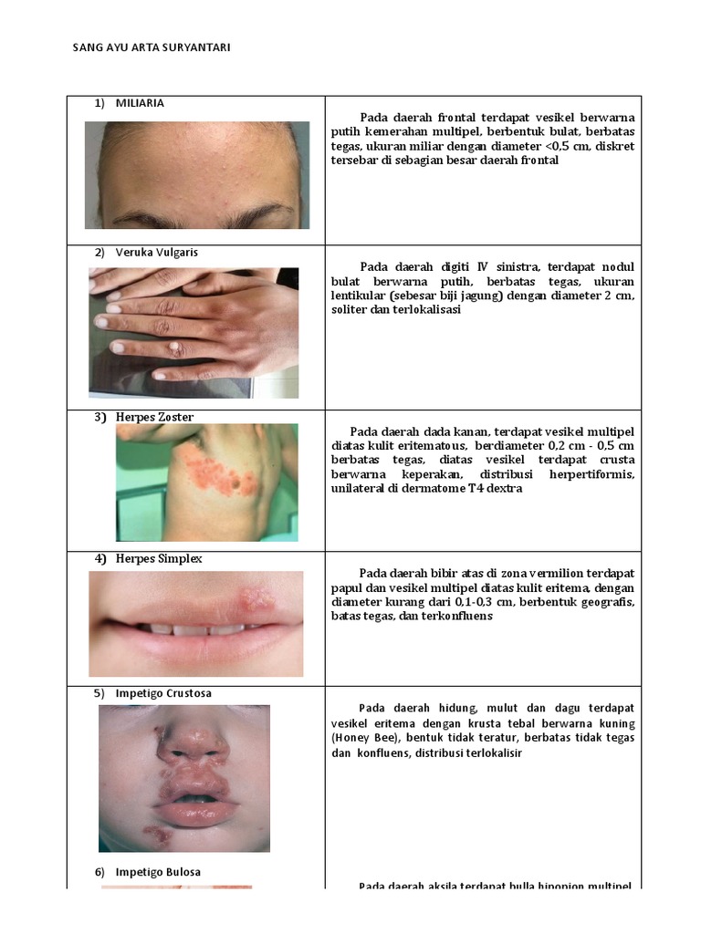 Skin Efloresensi | PDF