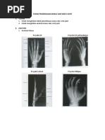 Thorax PA, AP Dan Lateral, RLD Dan LLD | PDF