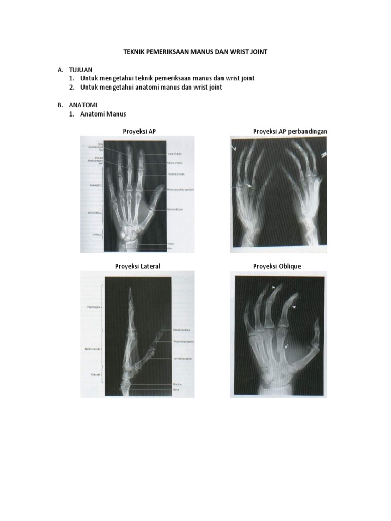 Laporan (Os - Manus Dan Wrist Joint) | PDF