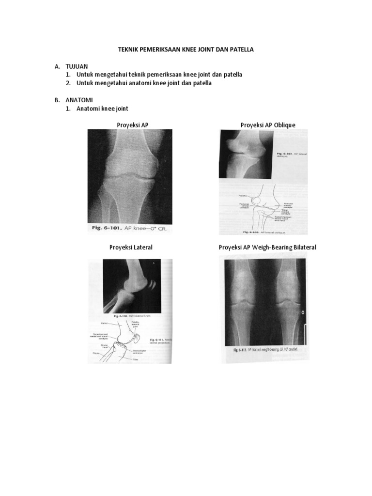 Laporan (Knee Joint Dan Patella) | PDF