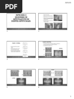 Códigos ICDAS para Diagnóstico de Caries | PDF | Esmalte de dientes | Flúor