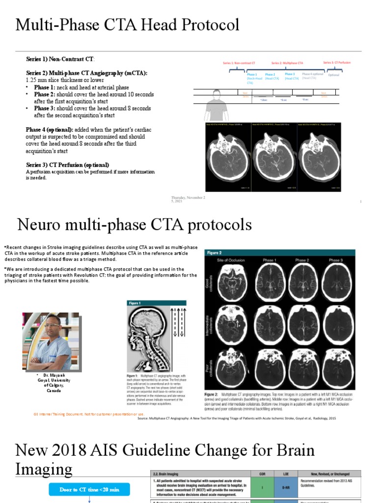 Multi-Phase CTA Head Protocol: Series 1) Non-Contrast CT: Series 2 ...
