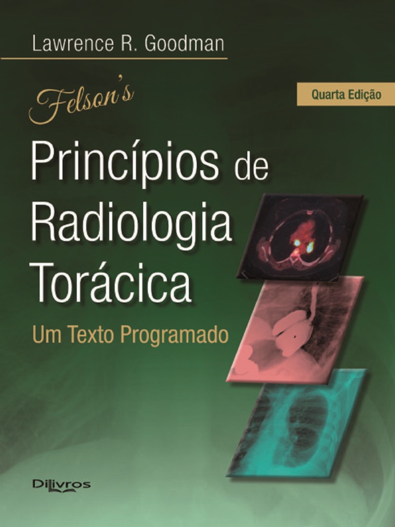 Felson's Princípios de Radiologia Torácica 4a Ed | PDF | Raio X | Pulmão