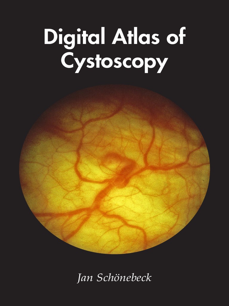 Digital Atlas of Cystoscopy: Jan Schönebeck | PDF | Prostate | Urinary ...