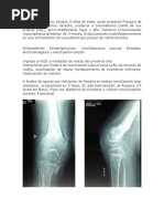 PALESTESIA Definicion y Exploración | PDF | Mano | Sistema ...