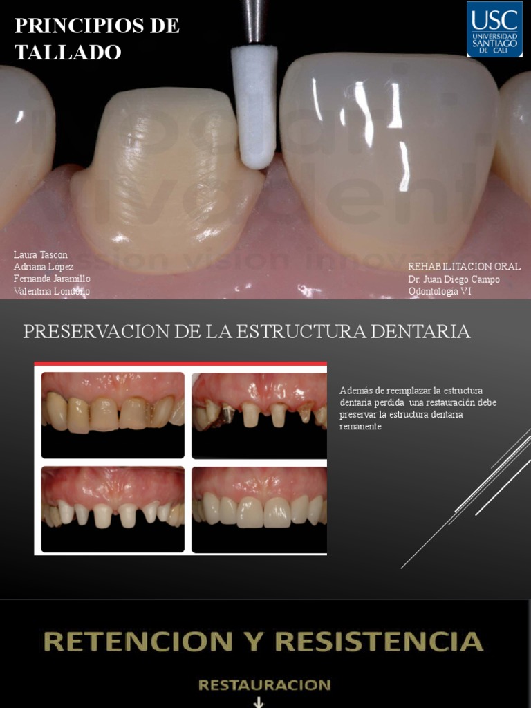 9.principios de Tallado | PDF | Ramas de Odontología | Odontología