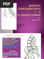 Signo del Perrito Escocés en Radiología | PDF | Vértebra | Medicina