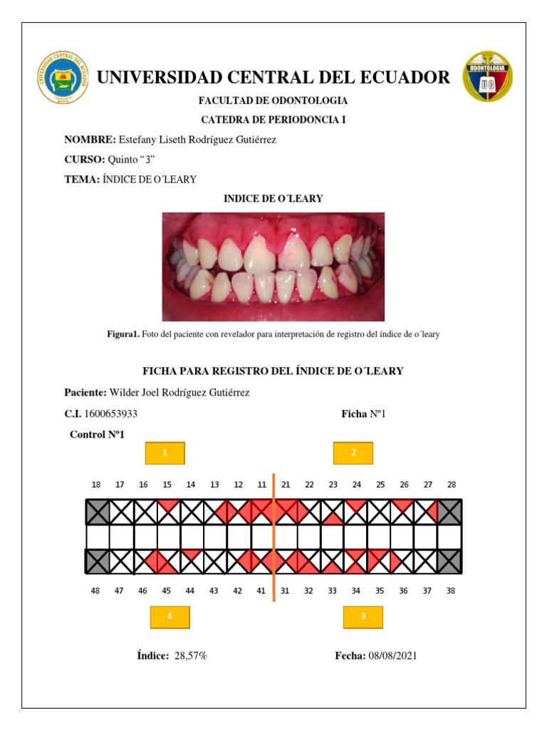 Índice de o Leary | PDF | Higiene oral | Odontología