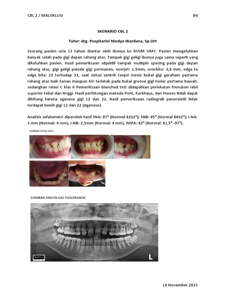 Notulensi CBL 2 Maloklusi - Kel.b4 - Compressed | PDF