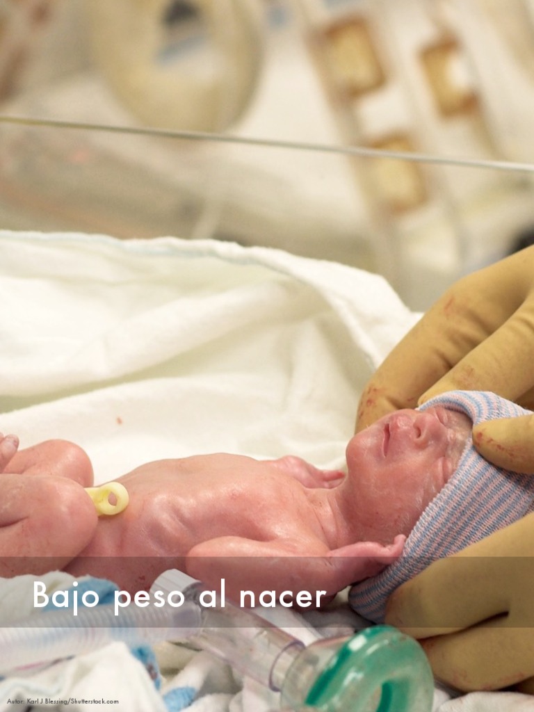 Consecuencias del Bajo Peso al Nacer | PDF | Infantes | El embarazo