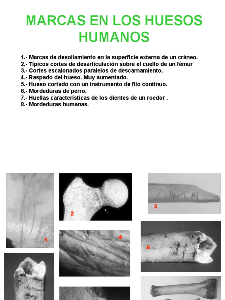 Análisis de marcas óseas para la identificación de causas de daño y ...