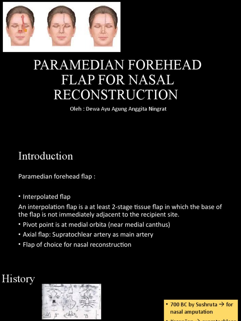 Paramedian Forehead Flap for Nasal Repair | PDF | Human Nose | Skin