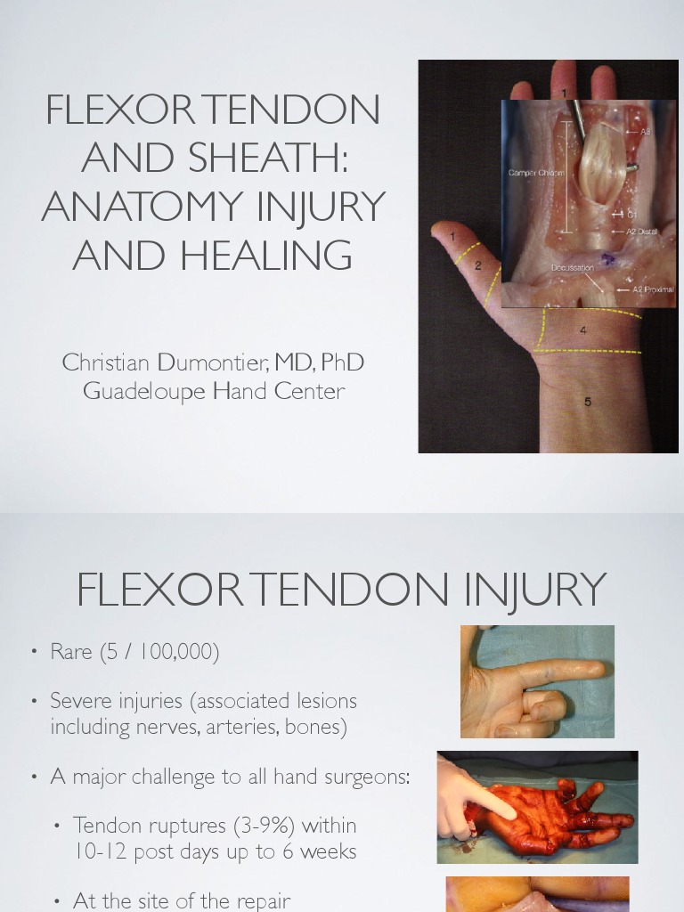 Flexor Tendon Injury and Healing | PDF | Tendon | Healing