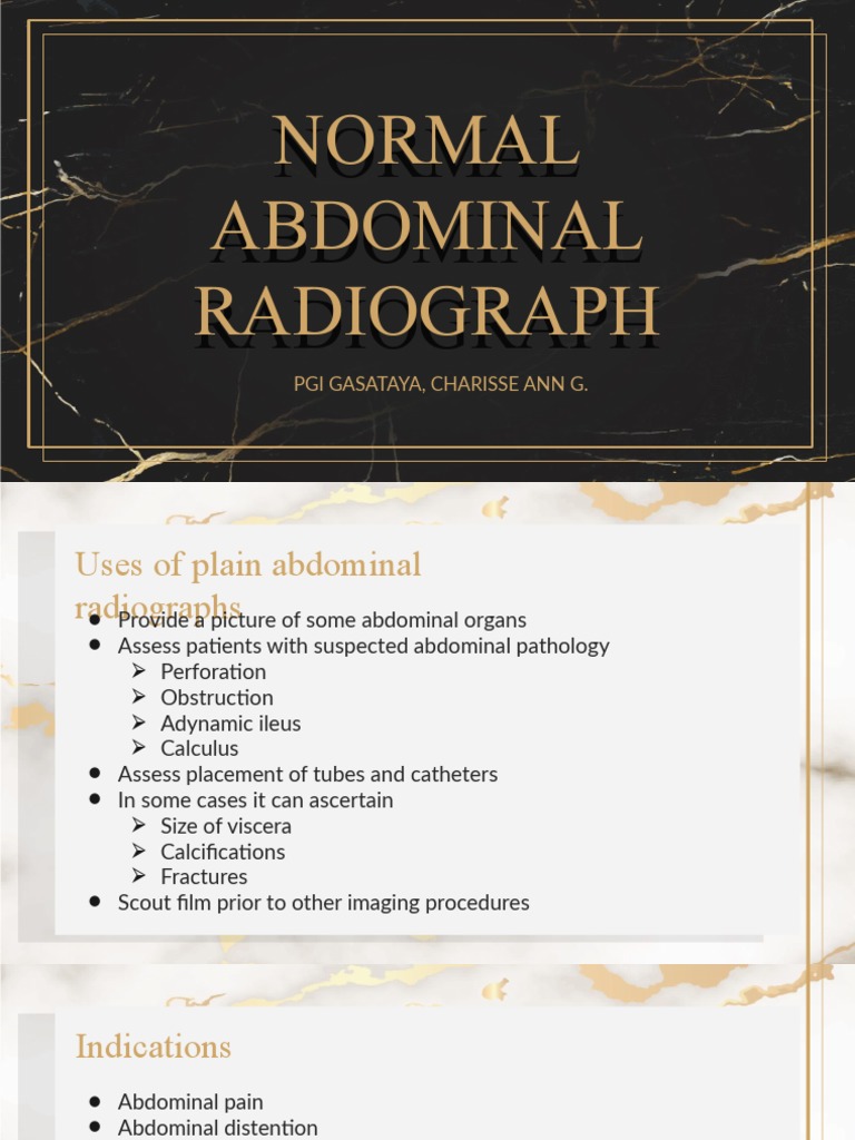 Normal Abdominal Radiograph | PDF | Vertebral Column | Abdomen