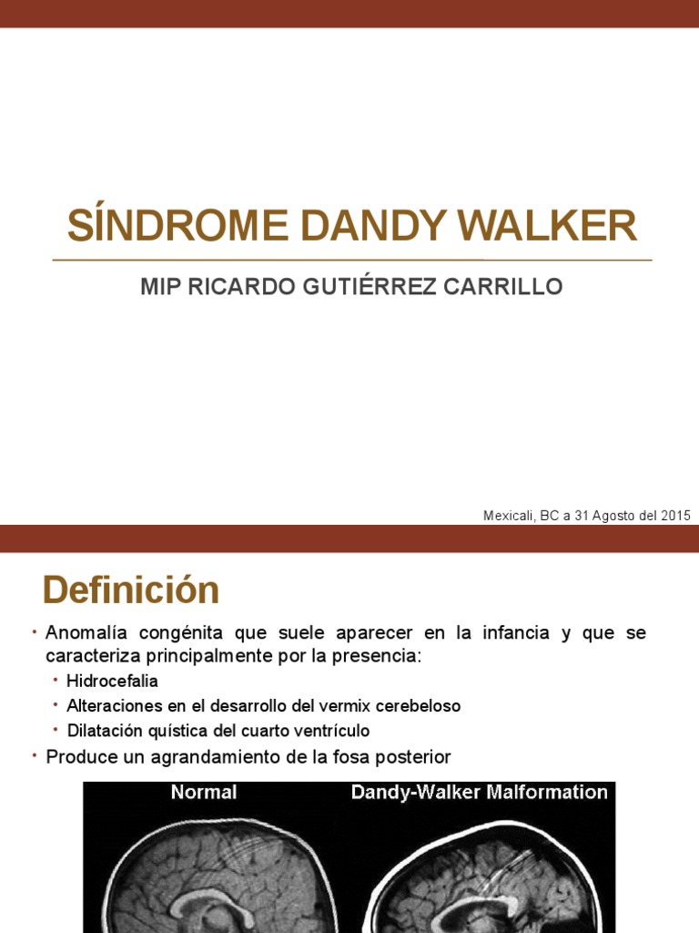 SX Dandy Walker | PDF | Enfermedades y trastornos humanos ...
