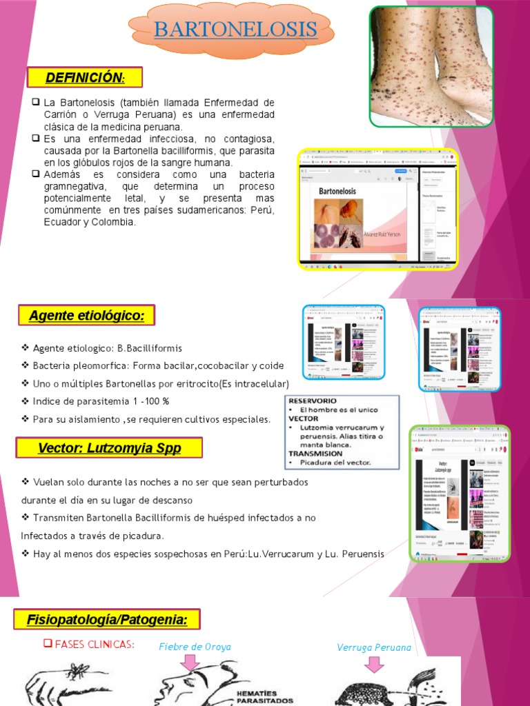 Bartonelosis | PDF | Especialidades Medicas | Enfermedades y trastornos