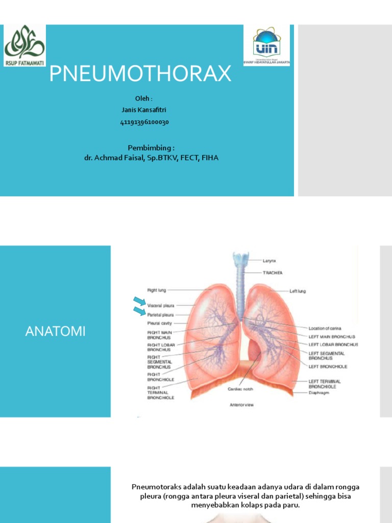 Manajemen Pneumotoraks | PDF