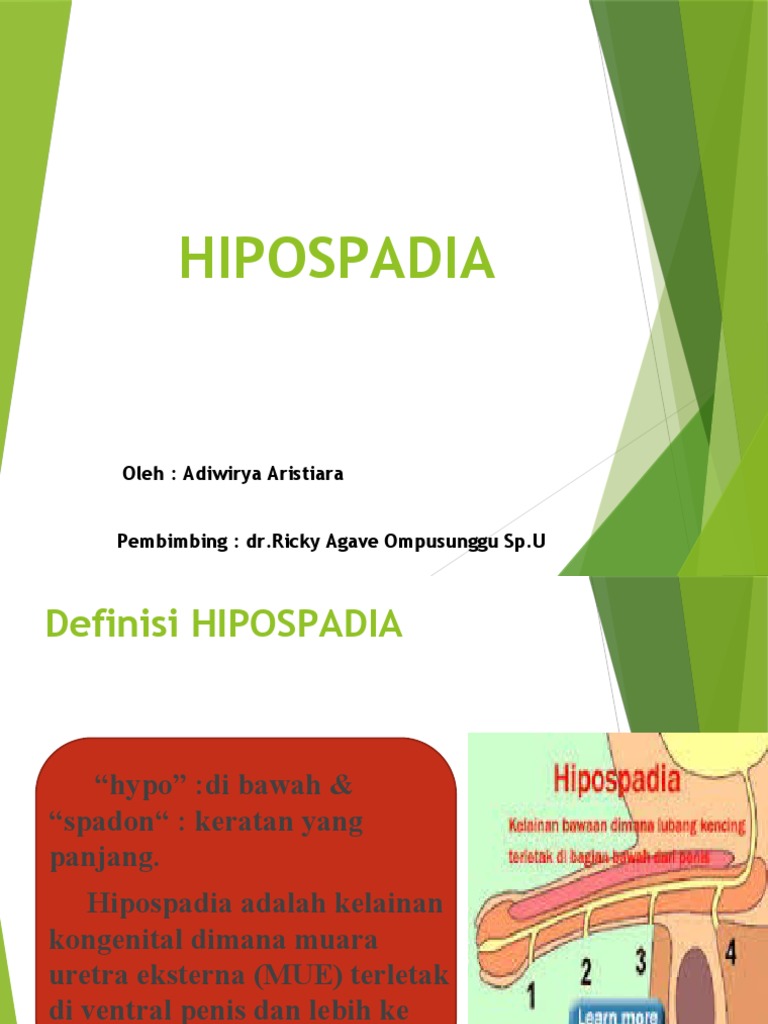 PPT-HIPOSPADIA - WIR (Autosaved) Baru | PDF