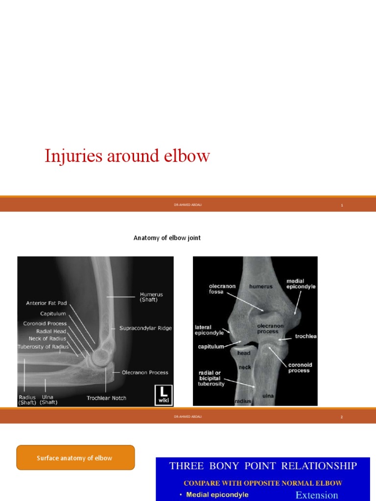 Elbow Dislocation DR - Ahmed Abdali | PDF | Elbow | Traumatology