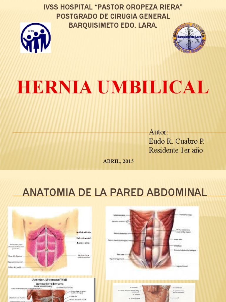 Hernia Umbilical | PDF