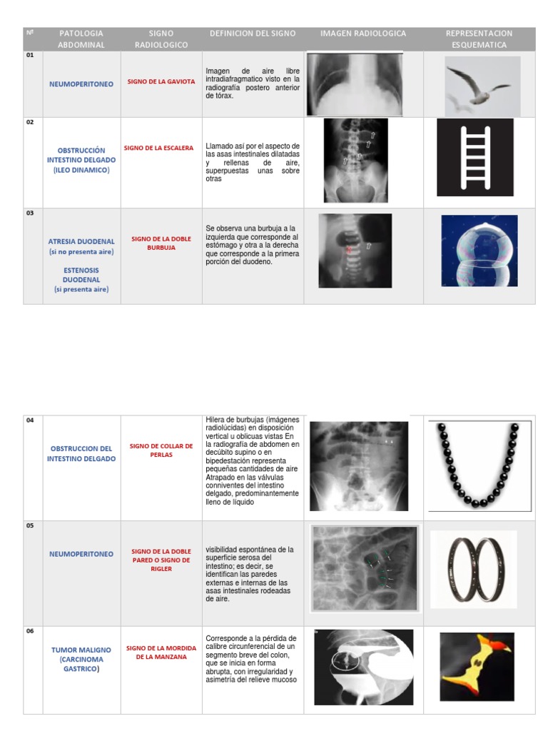 Signos Radiológicos del Abdomen | PDF | Estómago | Abdomen