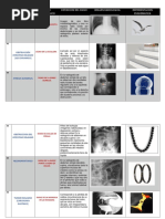 Signos de neumoperitoneo en radiografías | PDF | Abdomen | Hígado