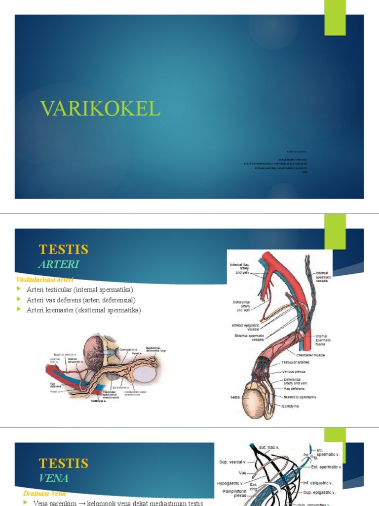Varicocele | PDF