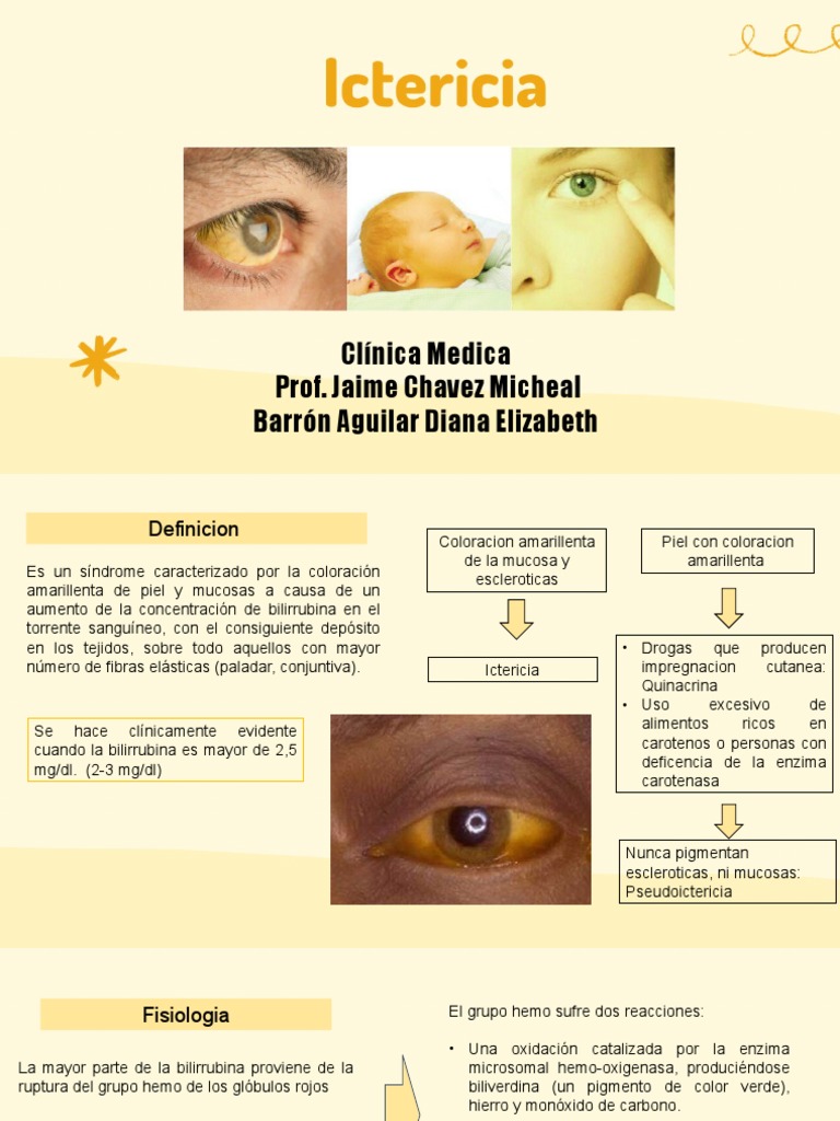 Ictericia | PDF | Enfermedades y trastornos | Medicina CLINICA