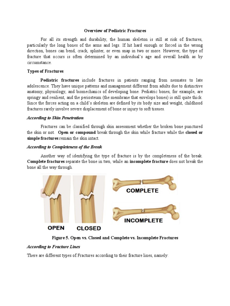 Basic Types of Bone Fractures | Download Free PDF | Bone | Clinical ...