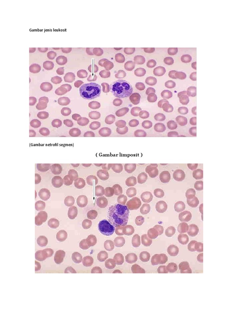 Gambar Jenis Leukosit-1 | PDF