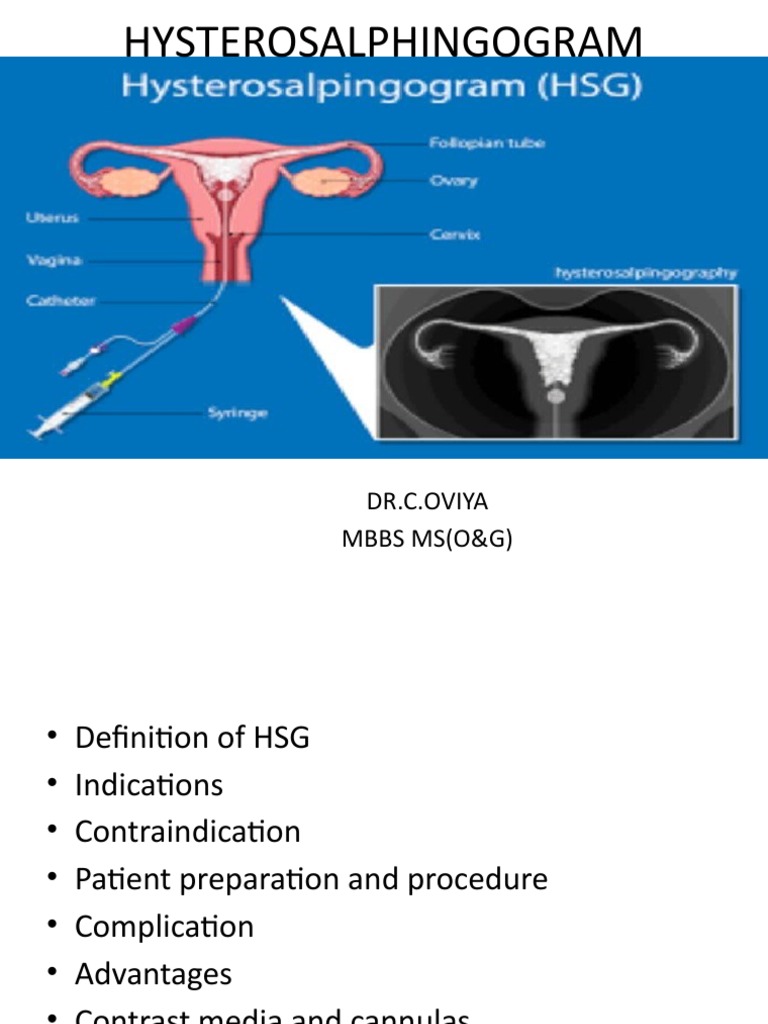 Hysterosalphingogram: Dr.C.Oviya Mbbs Ms (O&G) | PDF | Uterus | Sexual ...