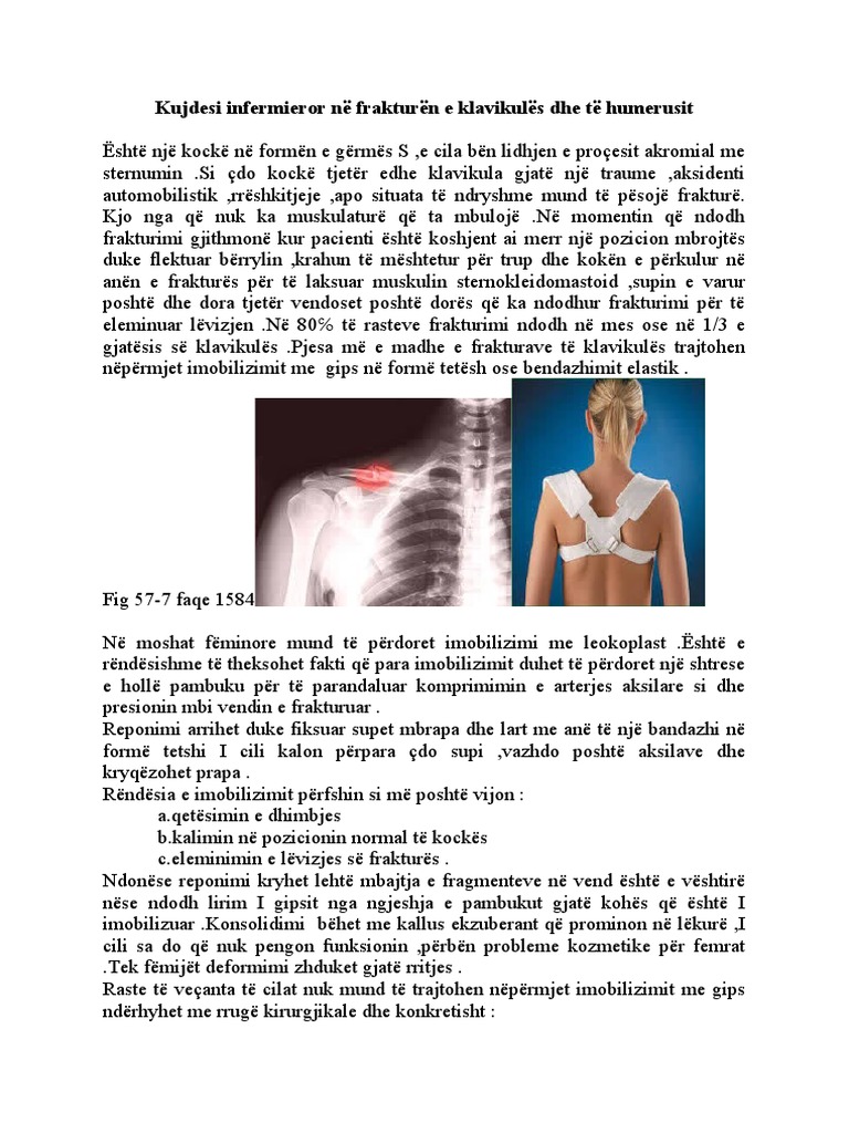 Kujdesi Infermieror Në Frakturën e Klavikulës Dhe Të Humerusit | PDF