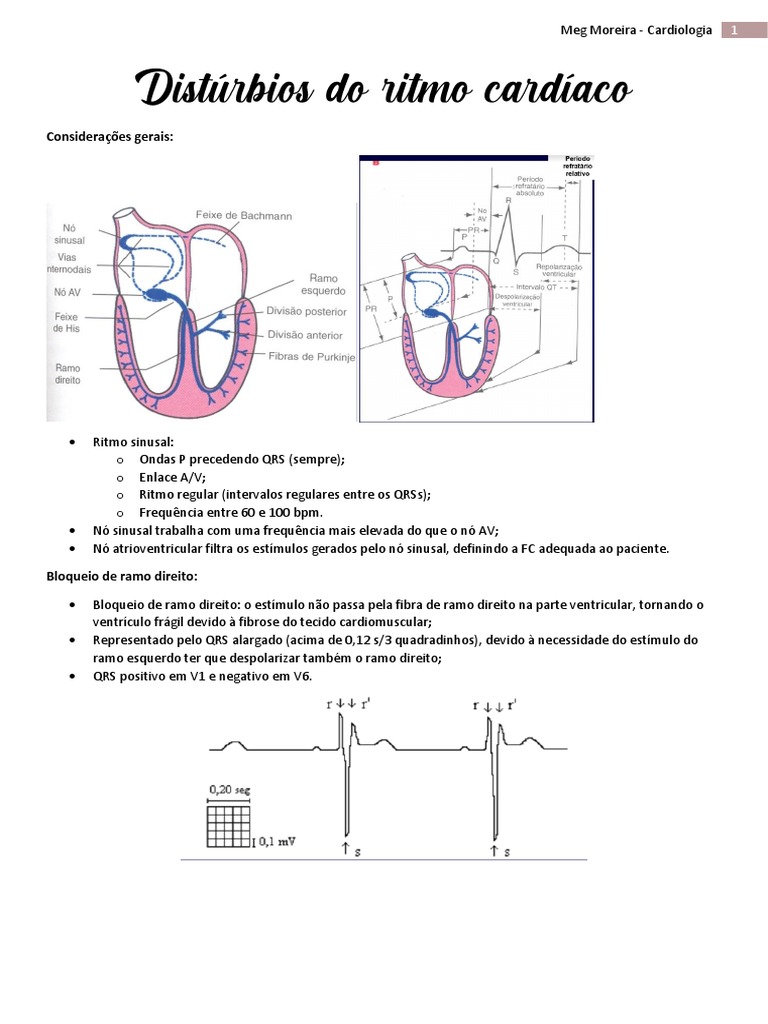 Cardiologia - Distúrbios Do Ritmo Cardíaco | PDF | Eletrocardiografia ...