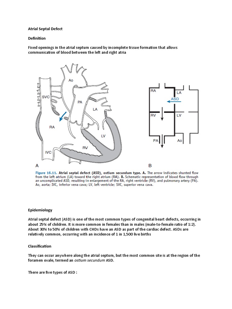 Atrial Septal Defect | PDF | Atrium (Heart) | Heart