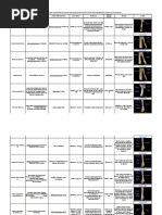 Hand - Extensor Tendon Repair Protocol PT (All) | PDF | Thumb | Hand