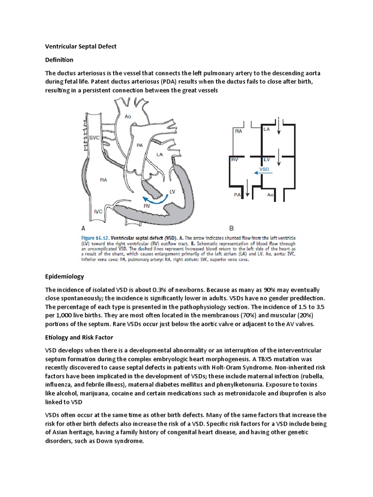 Ventricular Septal Defect | PDF | Congenital Heart Defect | Heart Valve
