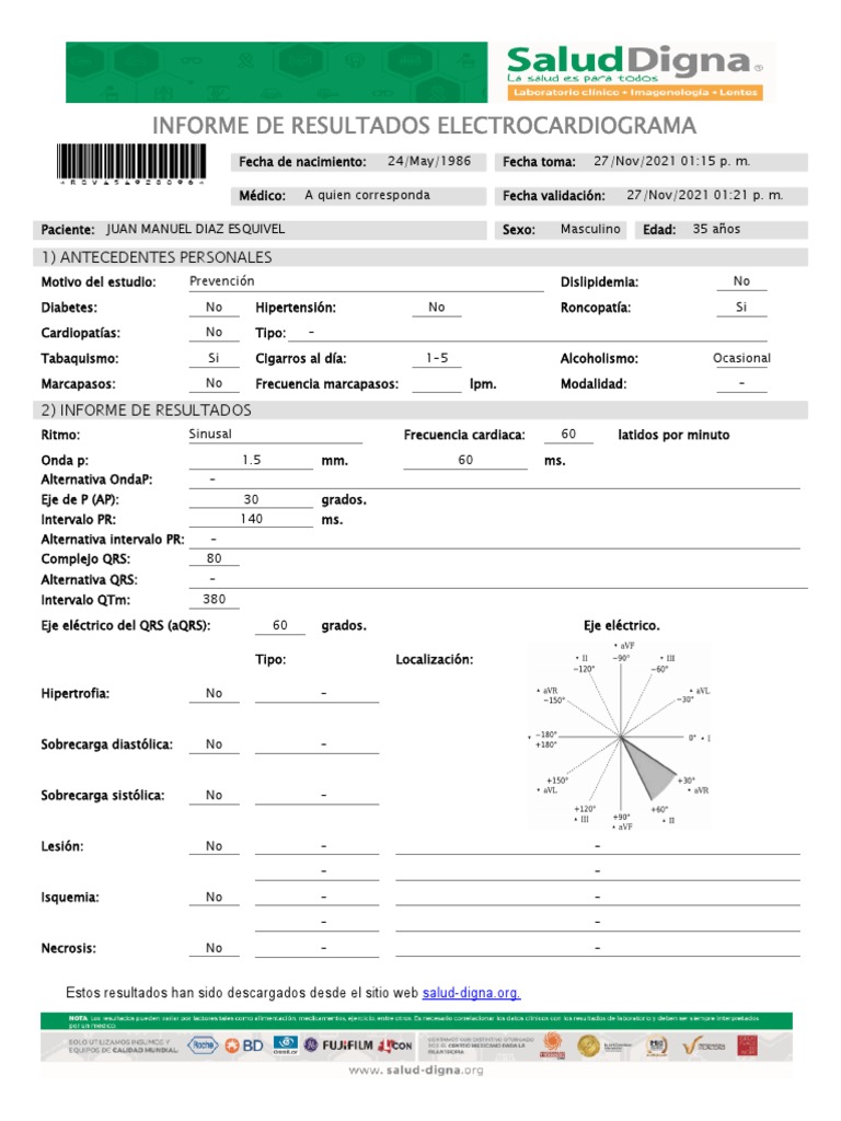 Electrocardiograma | PDF | Electrocardiografia | Ciencias de la Salud