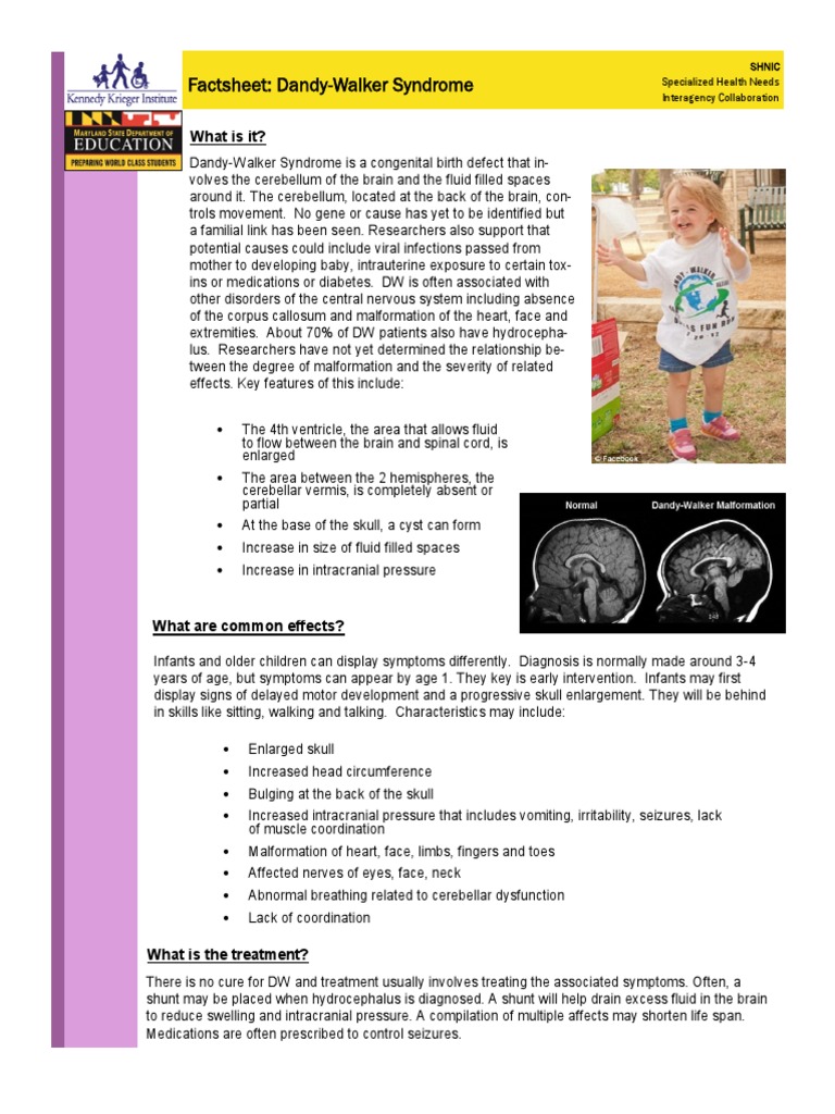 Factsheet: Dandy-Walker Syndrome: What Is It? | PDF | Neurology ...