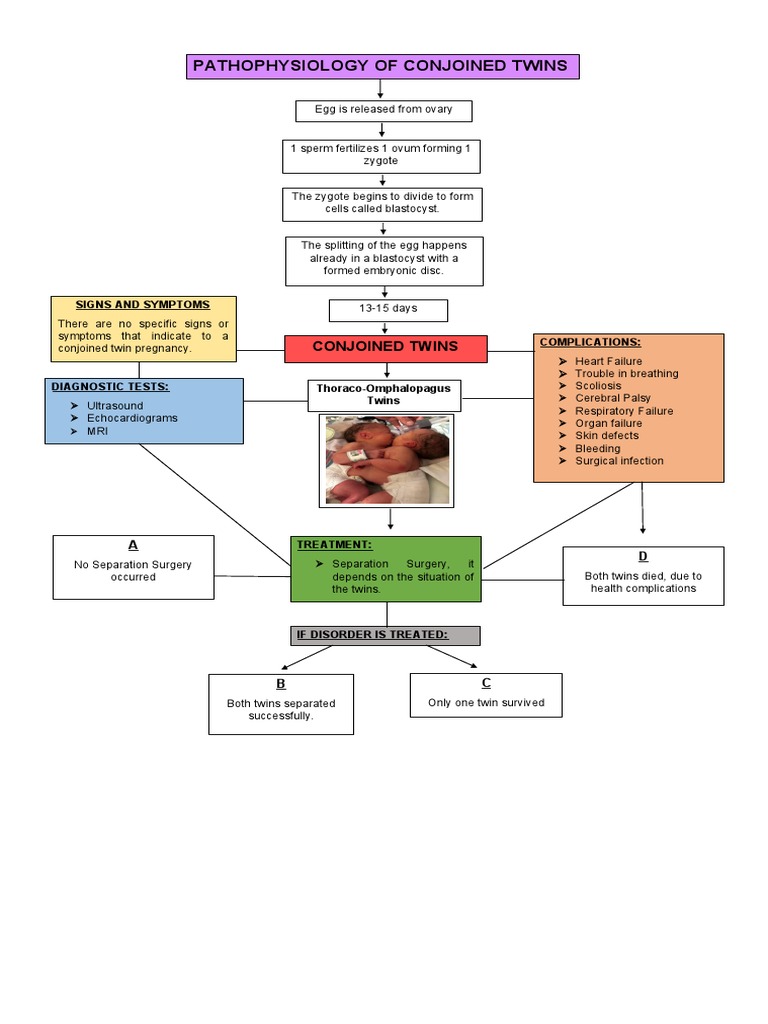 Pathophysiology of Conjoined Twins | PDF | Twin | Conjoined Twins