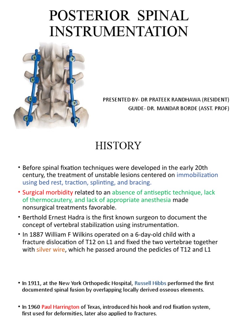 Posterior Spinal Instrumentation: Presented By-Dr Prateek Randhawa ...